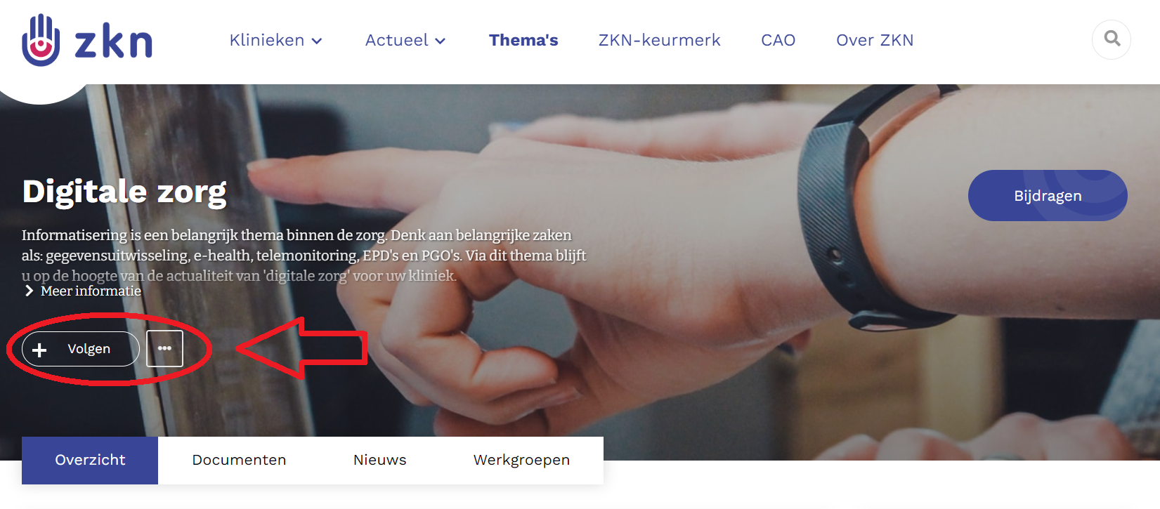 ZKN nieuws op maat? Stel uw voorkeuren in | ZKN